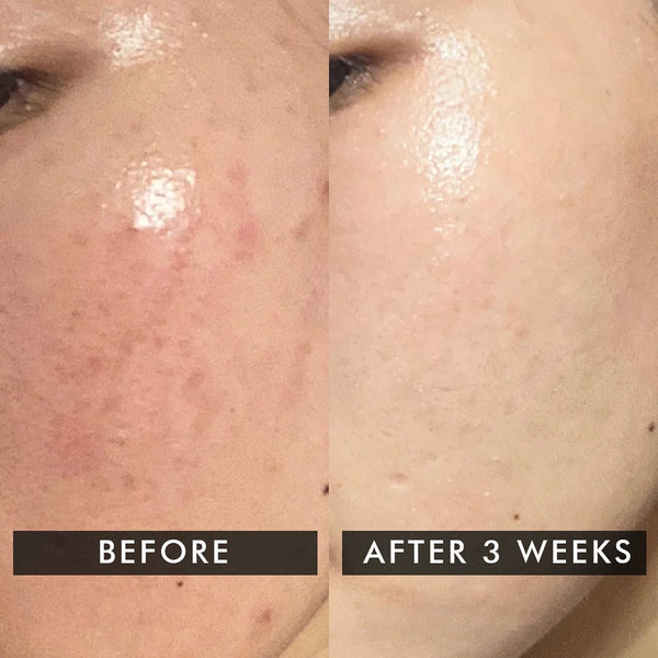 Buy our Snail Magic Essence with 97% Korean Snail Mucin – Conscious Chemist