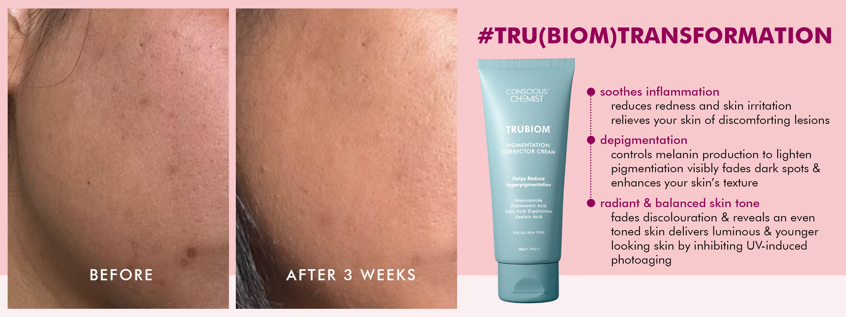 Pigmentation & Dark Spot Corrector Gel Cream – Conscious Chemist