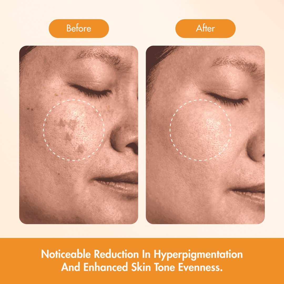 Buy Best Skincare Products online for Dullness | Conscious Chemist